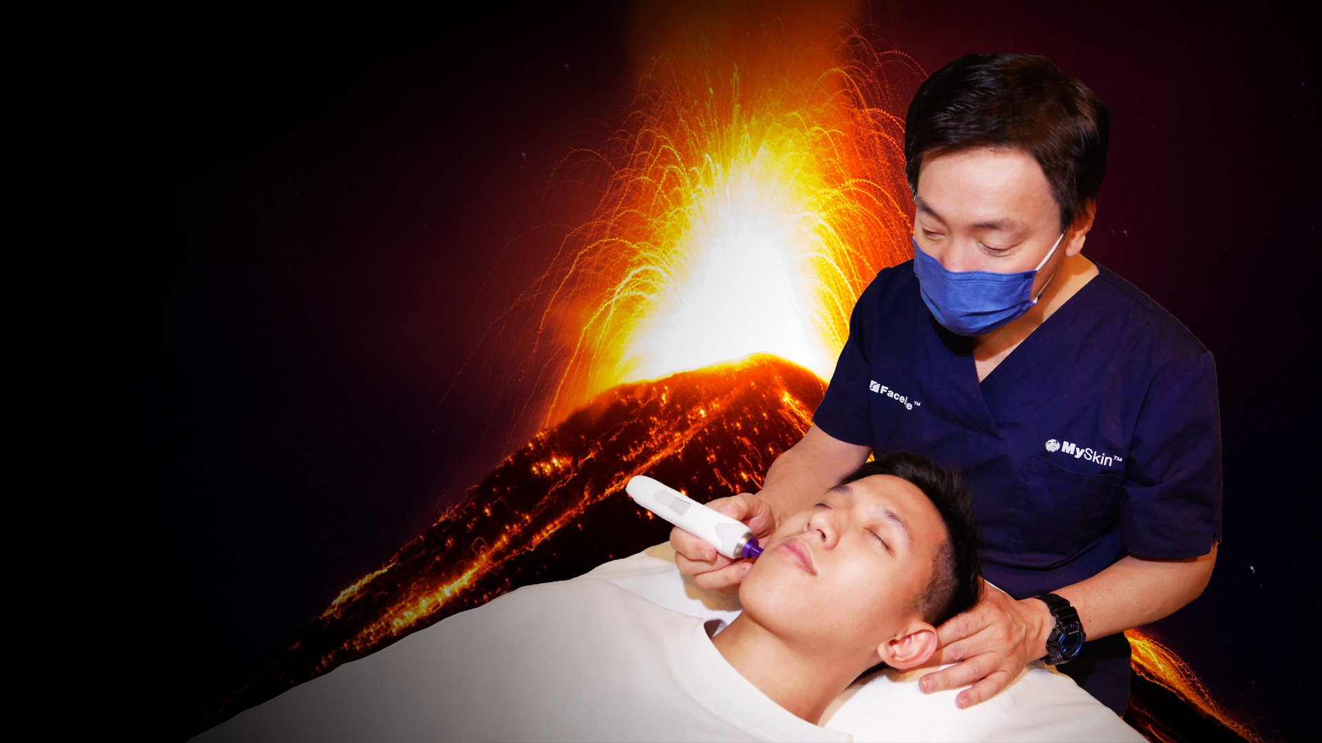 Acne Volcano Treatment Offer: $68 for 2 sessions
